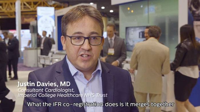 iFR Co-registration for Advanced Guidance | Philips